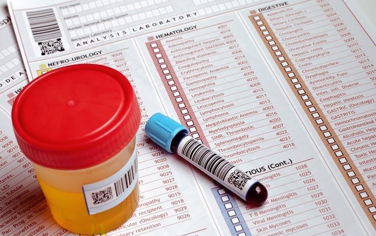 ¿Qué es la creatinina?